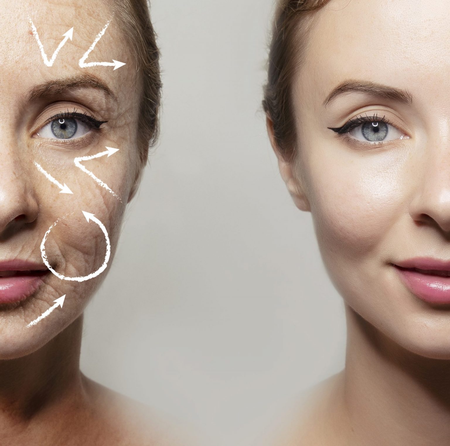 Skin Regeneration - SkinSpaceUK