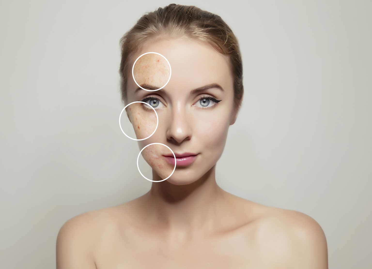 Congested Skin - SkinSpaceUK